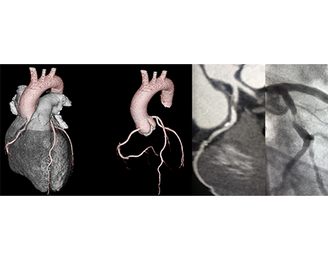 Cardiac CT Specialist - Tampa, FL: Alberto Morales, MD: Cardiologist ...