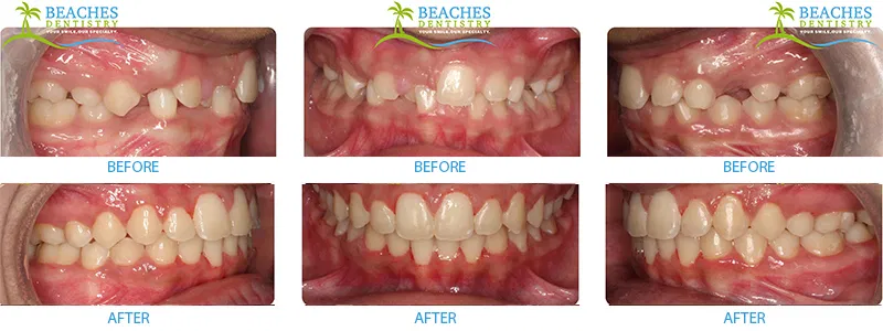 Before and After | Prosthodontists & Orthodontists located in ...