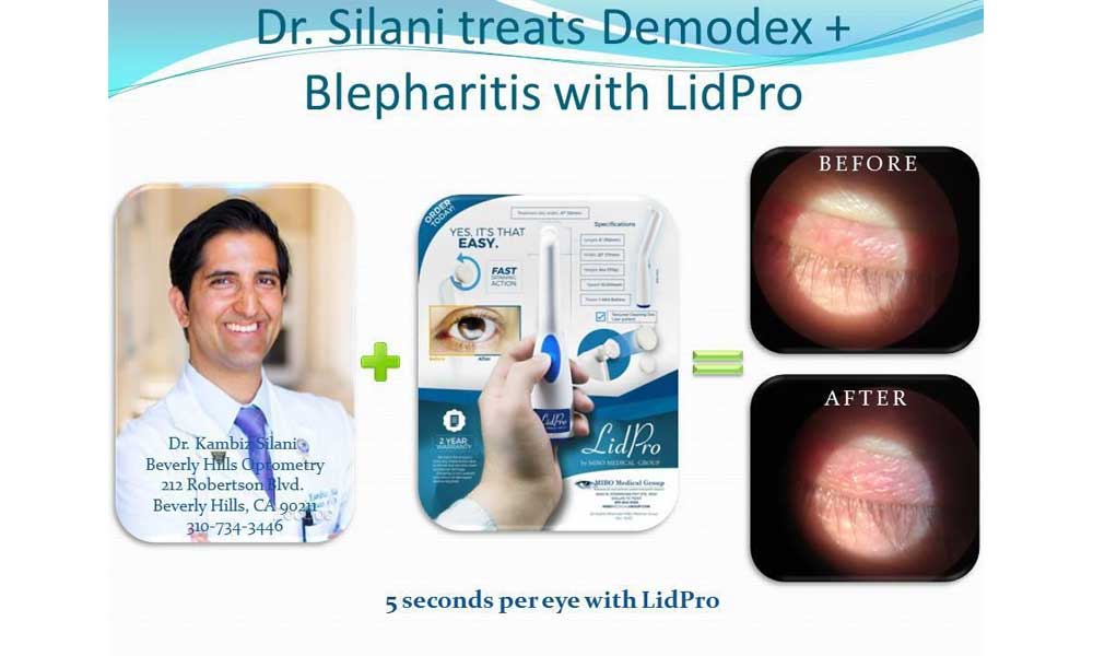 Blog: Beverly Hills Optometry: Optometrists Beverly Hills, CA