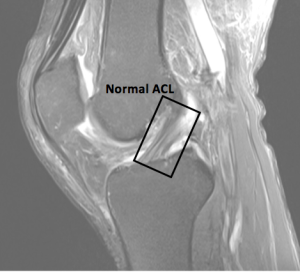 Media - Century City Los Angeles, CA: Millstein Orthopedics